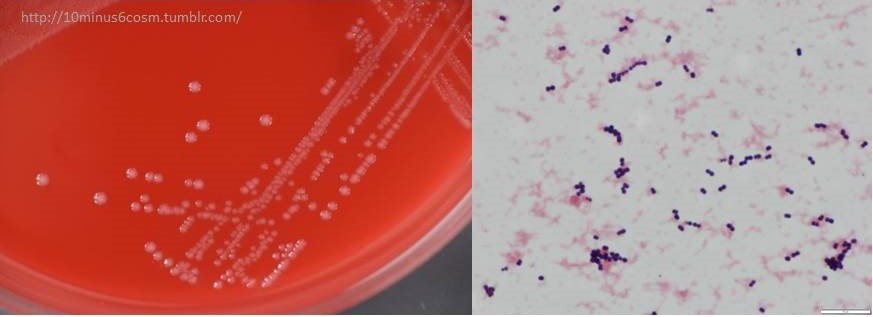 Microcosm Serious Group B Streptococcal Infection In Adults