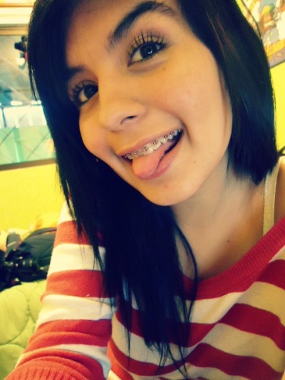 Braces Fetish On Tumblr