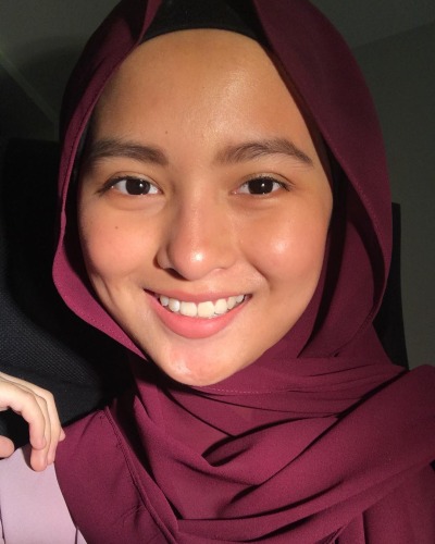 Terpancut Pancut Kat Muka Si Sara Ni Tumbex