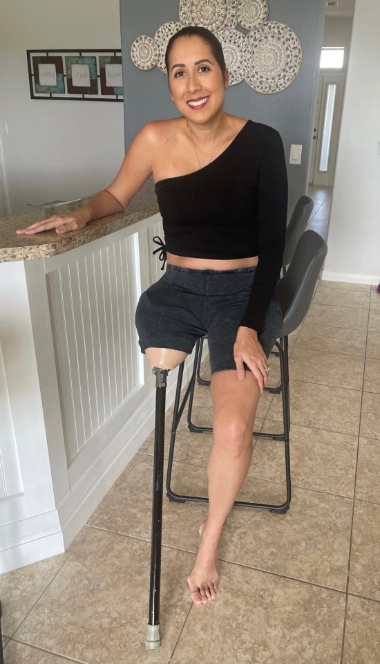 Amputee Eve On Tumblr