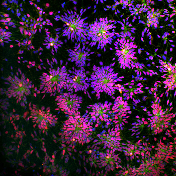 Biocanvas Neural Stem Cells Derived From Human Induced