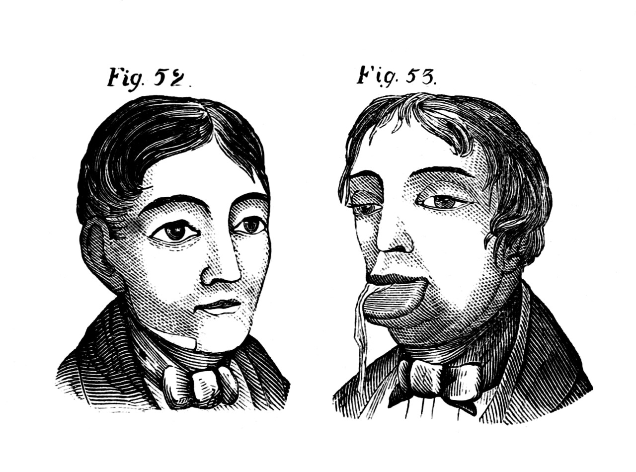 The Effect Of Masturbation Telegraph