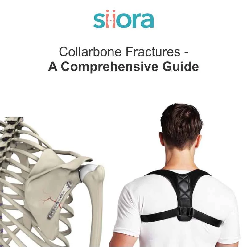 Collarbone Fractures – A Comprehensive Guide – @siorasurgicalsblog on ... Collarbone Fractures – A Comprehensive Guide – @siorasurgicalsblog on ...