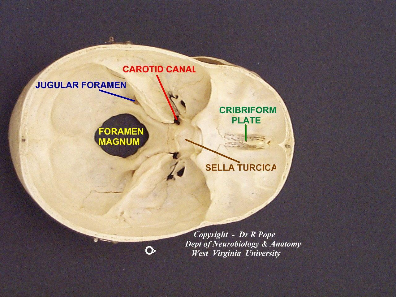 Miscellaneous Jugular Foramen