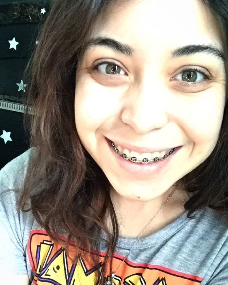 I Finally Got My Braces Off So Here Is The Last Drop The Sugar Peas