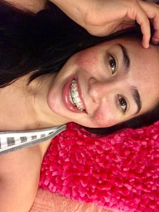 Sexy Girls With Braces On Tumblr