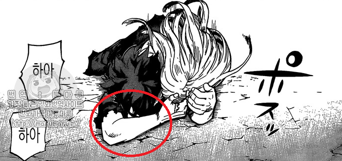 ☁ L E I N B O W ☁ In That Image Are Dekus Arm Scars From Muscular