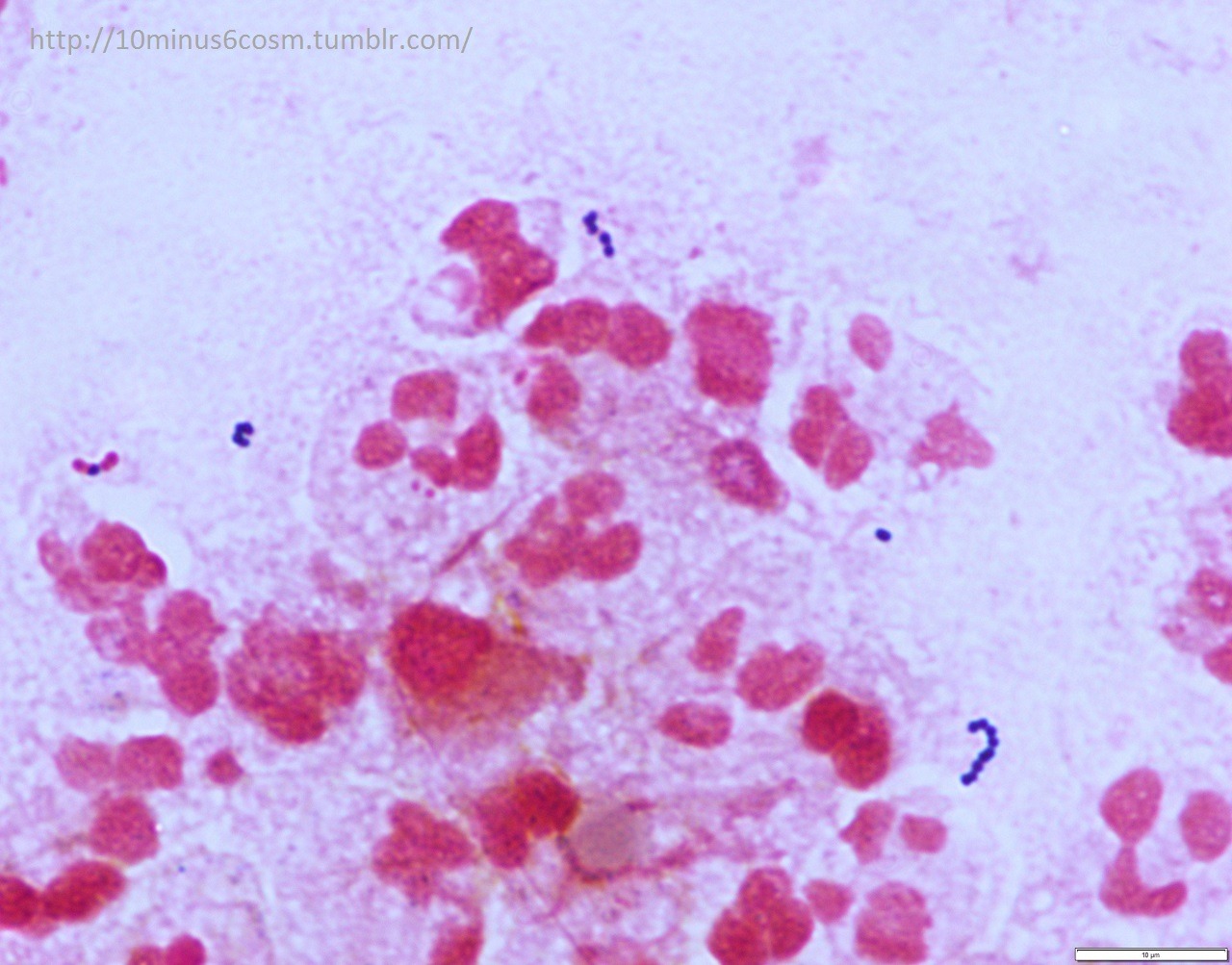 Streptococcus Pyogenes Gram Stain