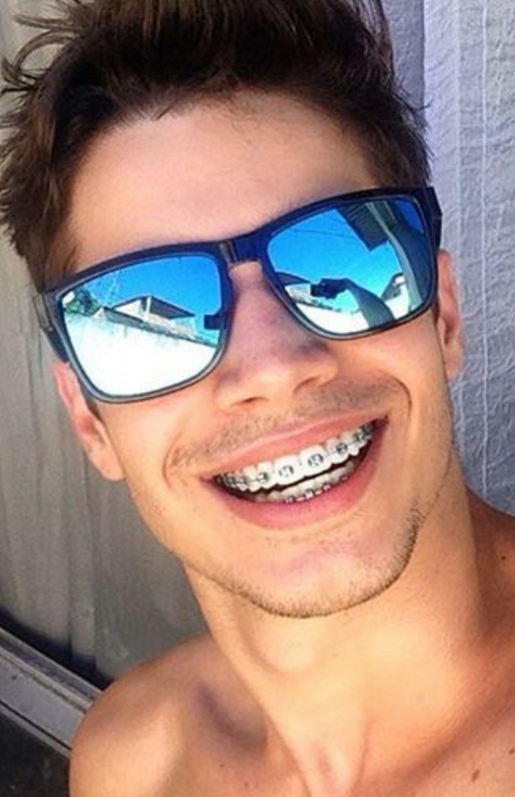 Hotguyswithbraces On Tumblr