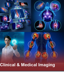 Information Theoretic Framework for MRI Preprocessing, Multiclass Feature Selection and ...