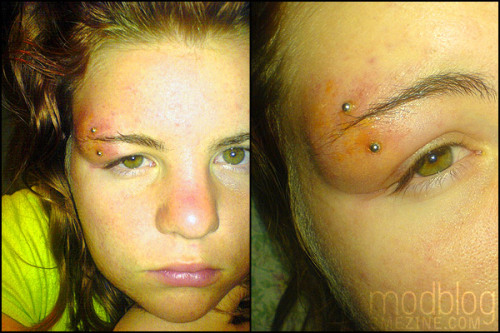 Infected eyebrow piercing store